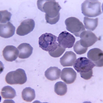 NATIONAL BUG BUSTING DAY - June 15, 2026 - National Today