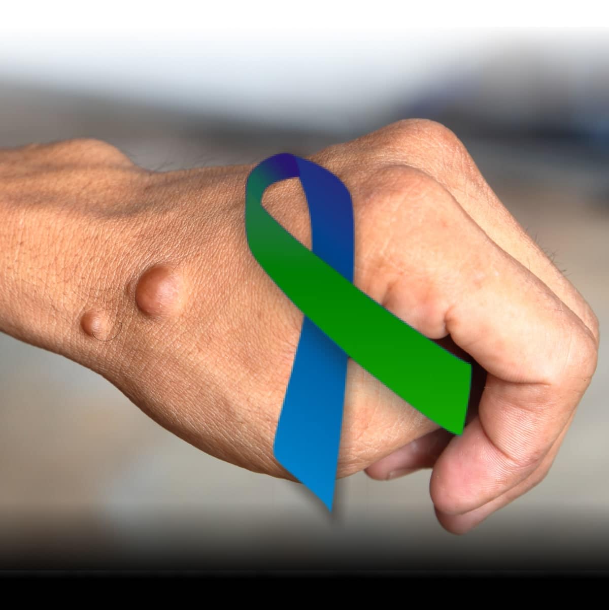 Neurofibromatosis Month - National Today