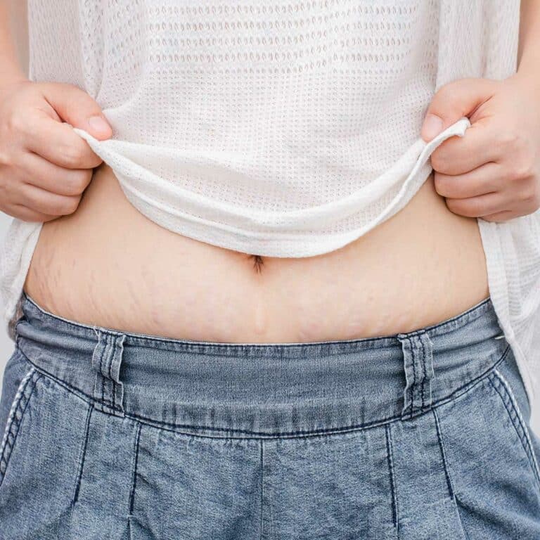 NATIONAL BACKYARD DAY - March 19, 2025 - National Today